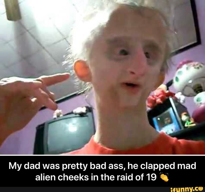 Clapsomecheeks memes. Best Collection of funny Clapsomecheeks pictures ...