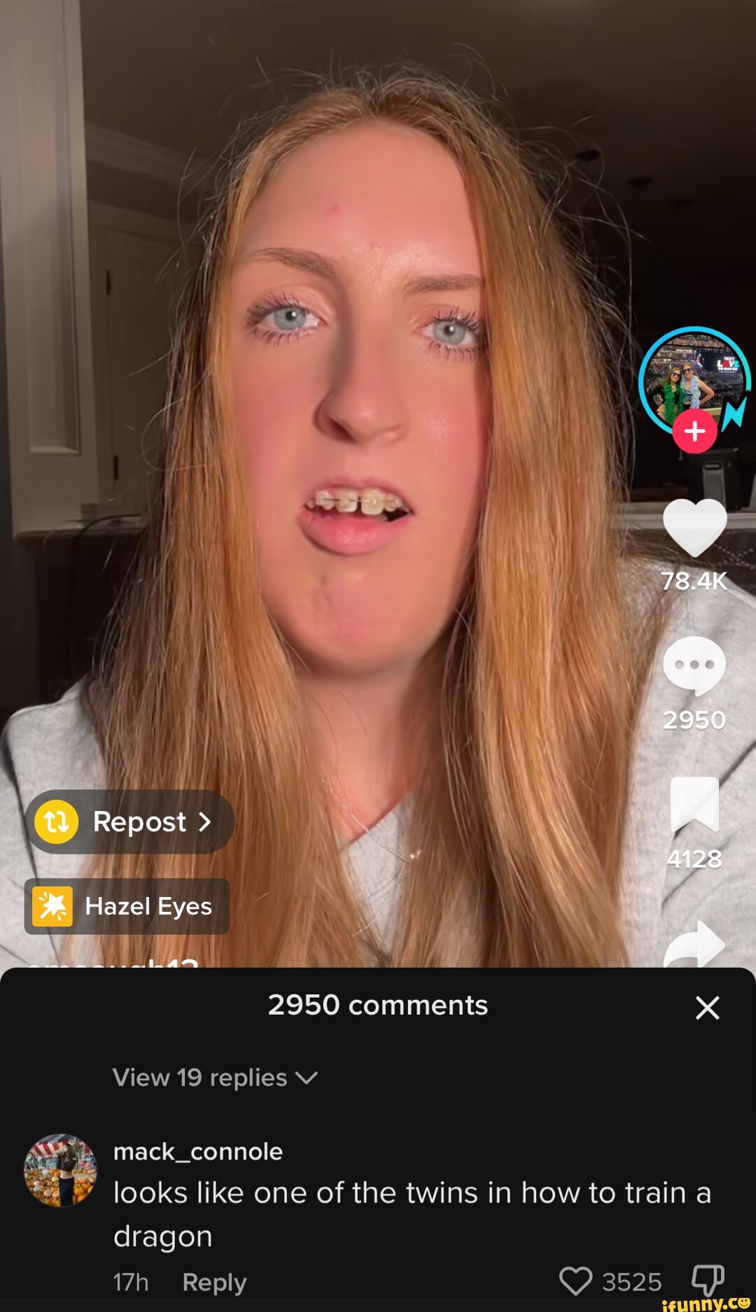 2950 Hazel Eyes 2950 comments View 19 replies mack_ connole looks like ...