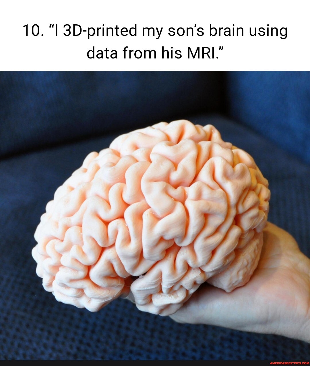 10. 3D-printed my son's brain using data from his MRI." - America’s ...