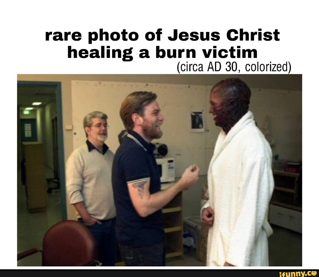 Rare photo of Jesus Christ healing a burn victim (circa AD 30 ...