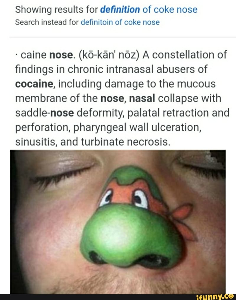 Showing results for deﬁnition of coke nose Search instead for deﬁnitoin ...