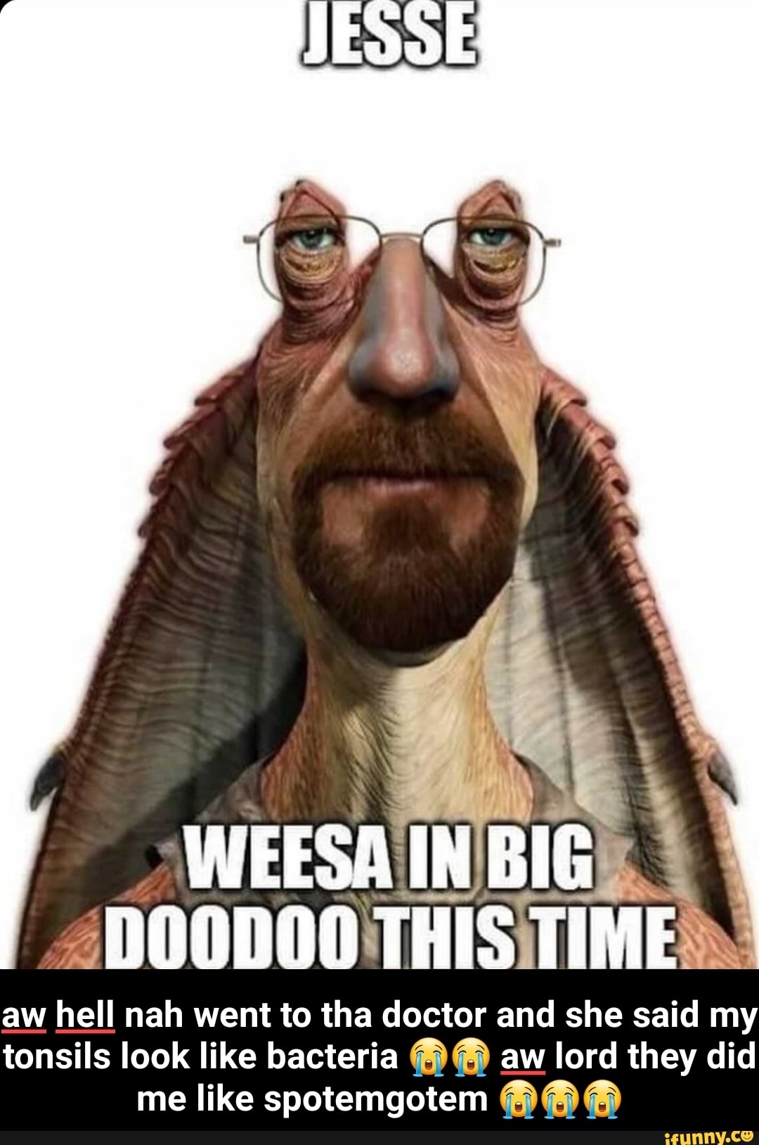 Tonsils memes. Best Collection of funny Tonsils pictures on iFunny