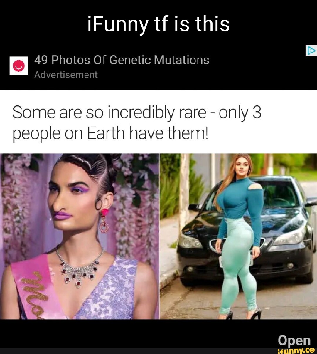 49 Photos Of Genetic Mutations Advertisement Some are so incredibly ...