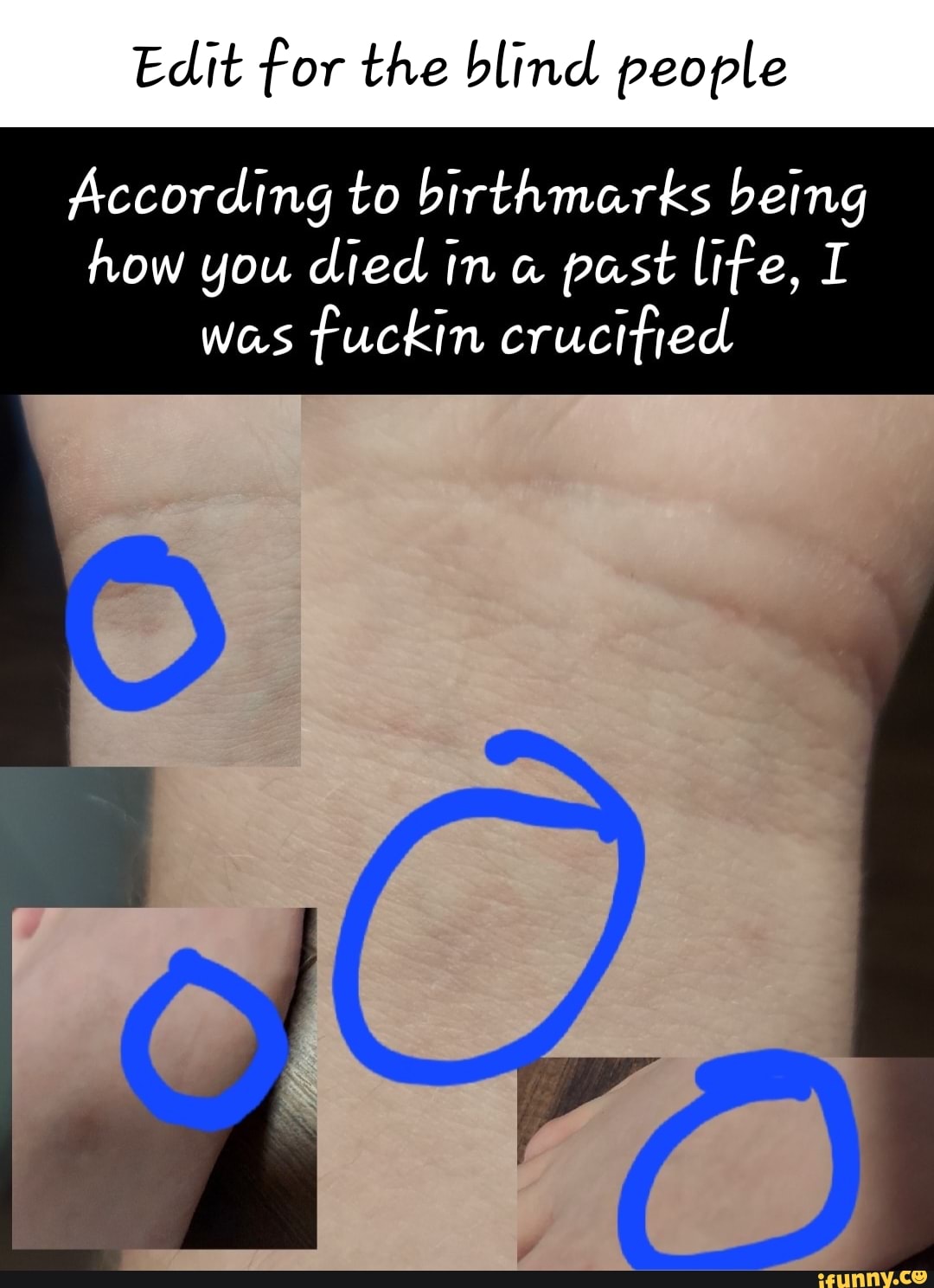 Birthmarks memes. Best Collection of funny Birthmarks pictures on iFunny