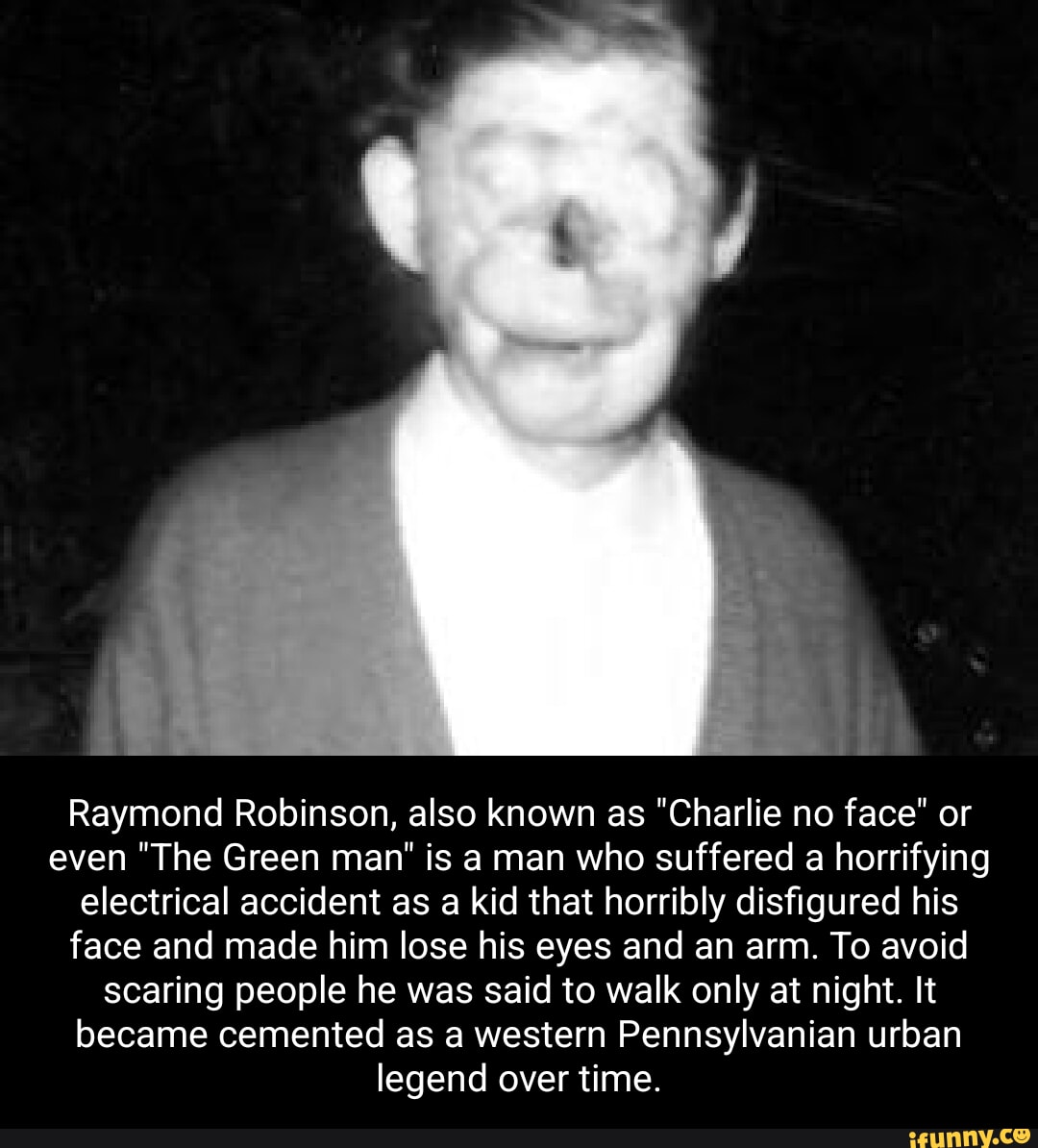 We Raymond Robinson, also known as "Charlie no face" or even "The Green ...