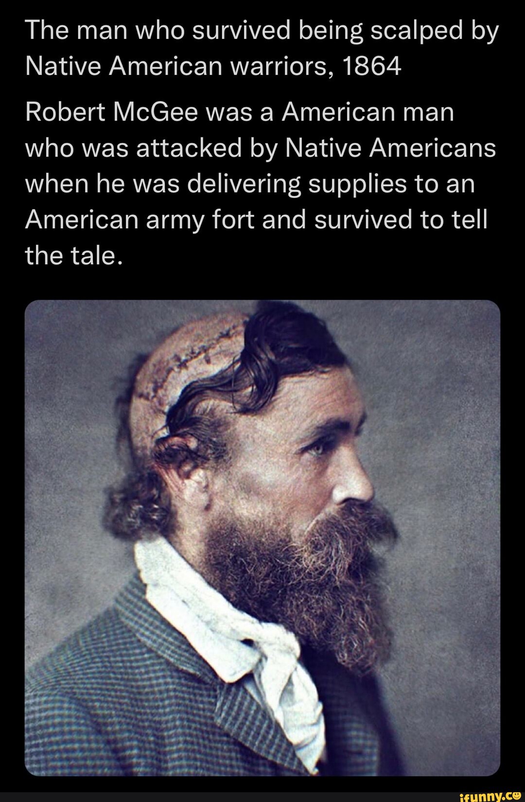 The man who survived being scalped by Native American warriors, 1864 ...