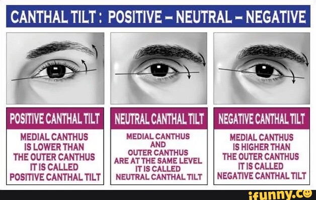 CANTHAL TILT: POSITIVE NEUTRAL NEGATIVE POSITIVE CANTHAL TILT NEUTRAL ...