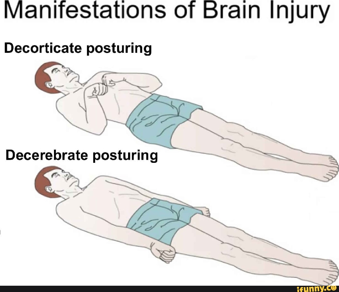 Posturing memes. Best Collection of funny Posturing pictures on iFunny