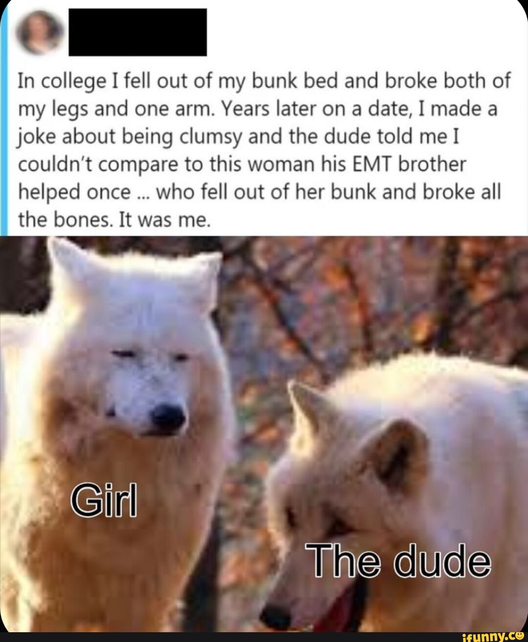 In college I fell out of my bunk bed and broke both of my legs and one ...