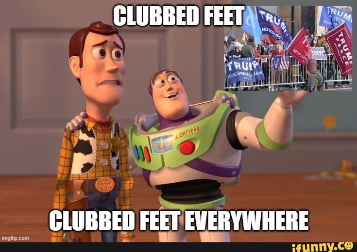 CLUBBED FEET CLUBBED FEET EVERYWHERE - iFunny