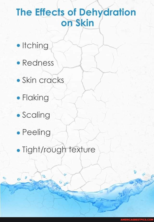 The Effects of Dehydration on Skin e liching e Redness Skin cracks e ...