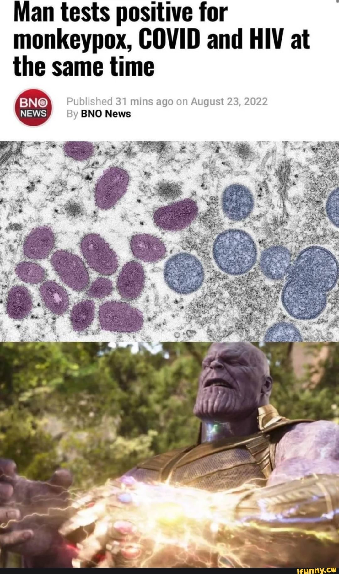 Man tests positive for monkeypox, COVID and HIV at the same time ...