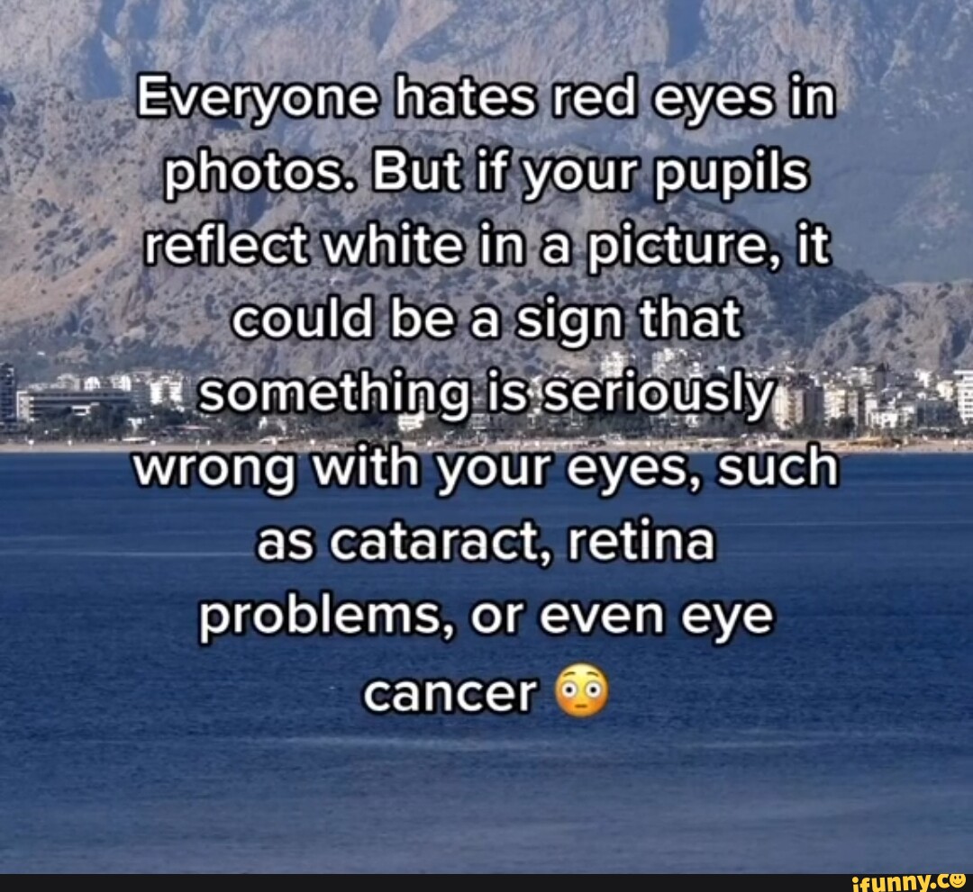 Everyone hates red eyes In photos. But if your pupils reflect white in ...