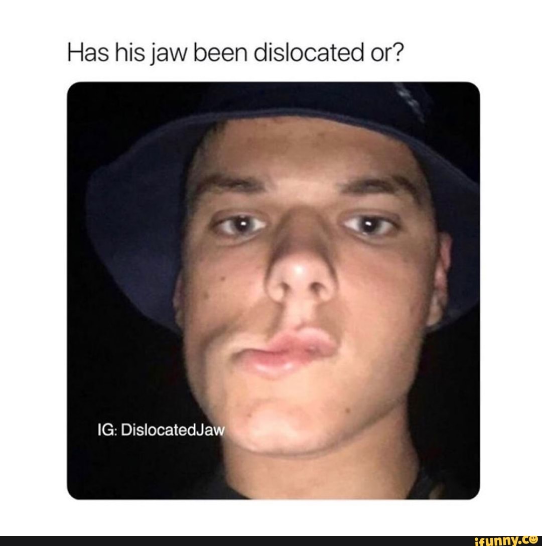 Has his jaw been dislocated or? - iFunny
