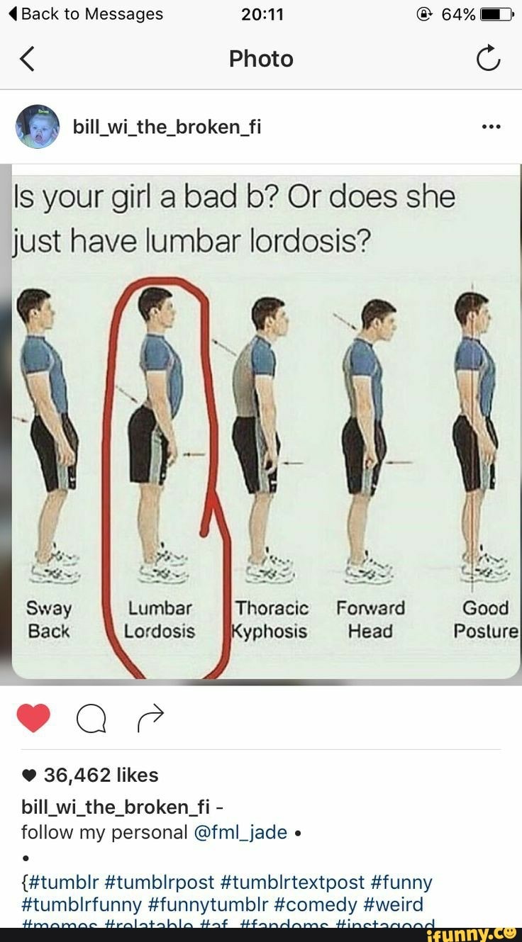 Lordosis memes. Best Collection of funny Lordosis pictures on iFunny