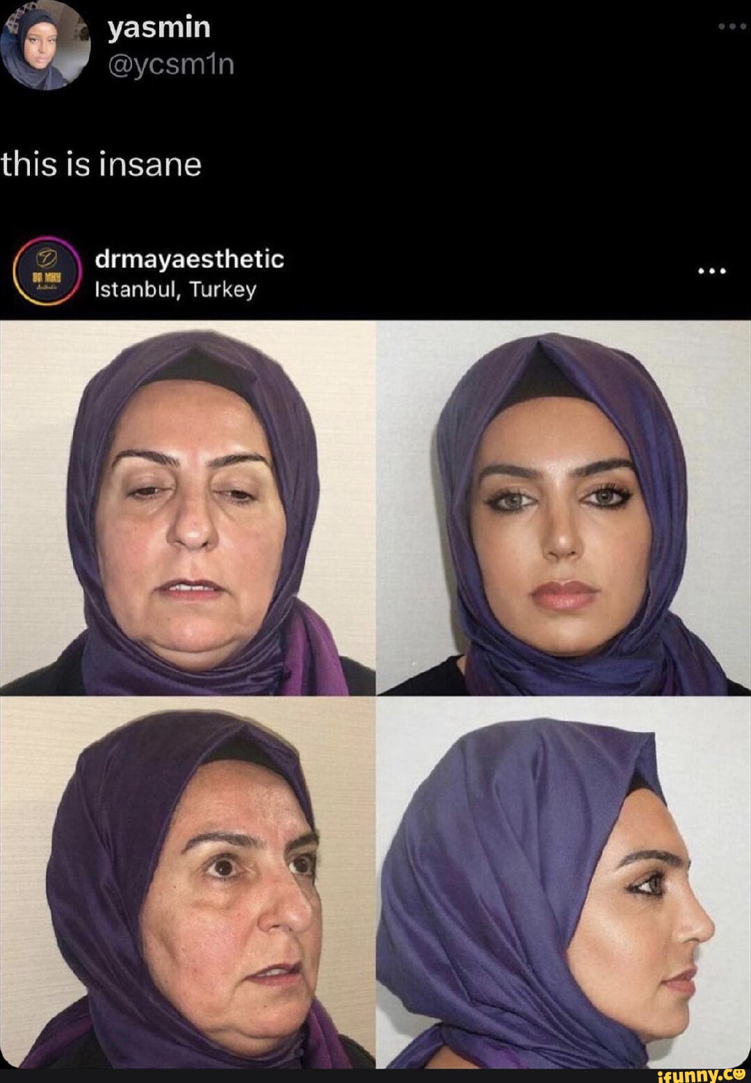 Istanbul memes. Best Collection of funny Istanbul pictures on iFunny