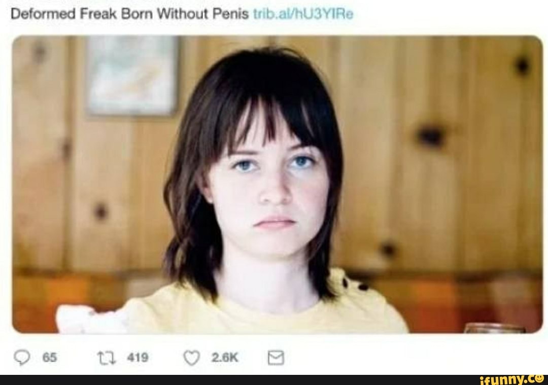 Deformed Freak Born Without Penis - iFunny