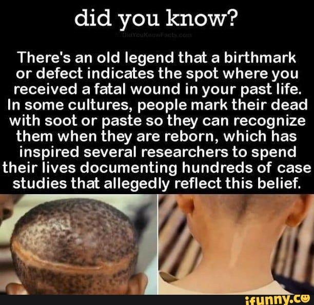 Did you know? There's an old legend that a birthmark or defect ...