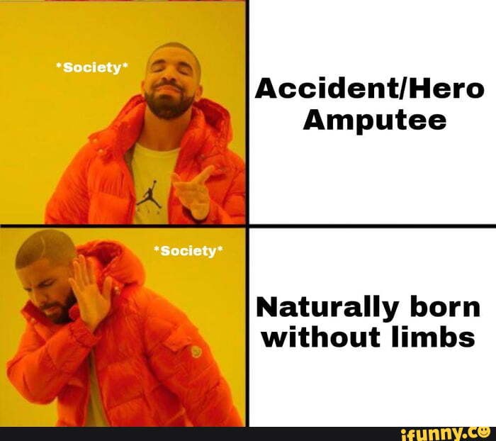 Amputee *Society* Naturally born without limbs - iFunny