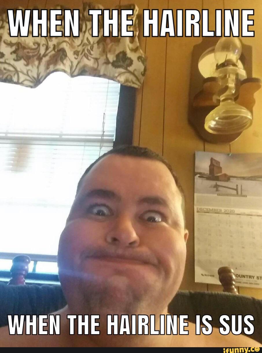 WHEN THE HAIRLINE WHEN THE HAIRLINE IS SUS - iFunny