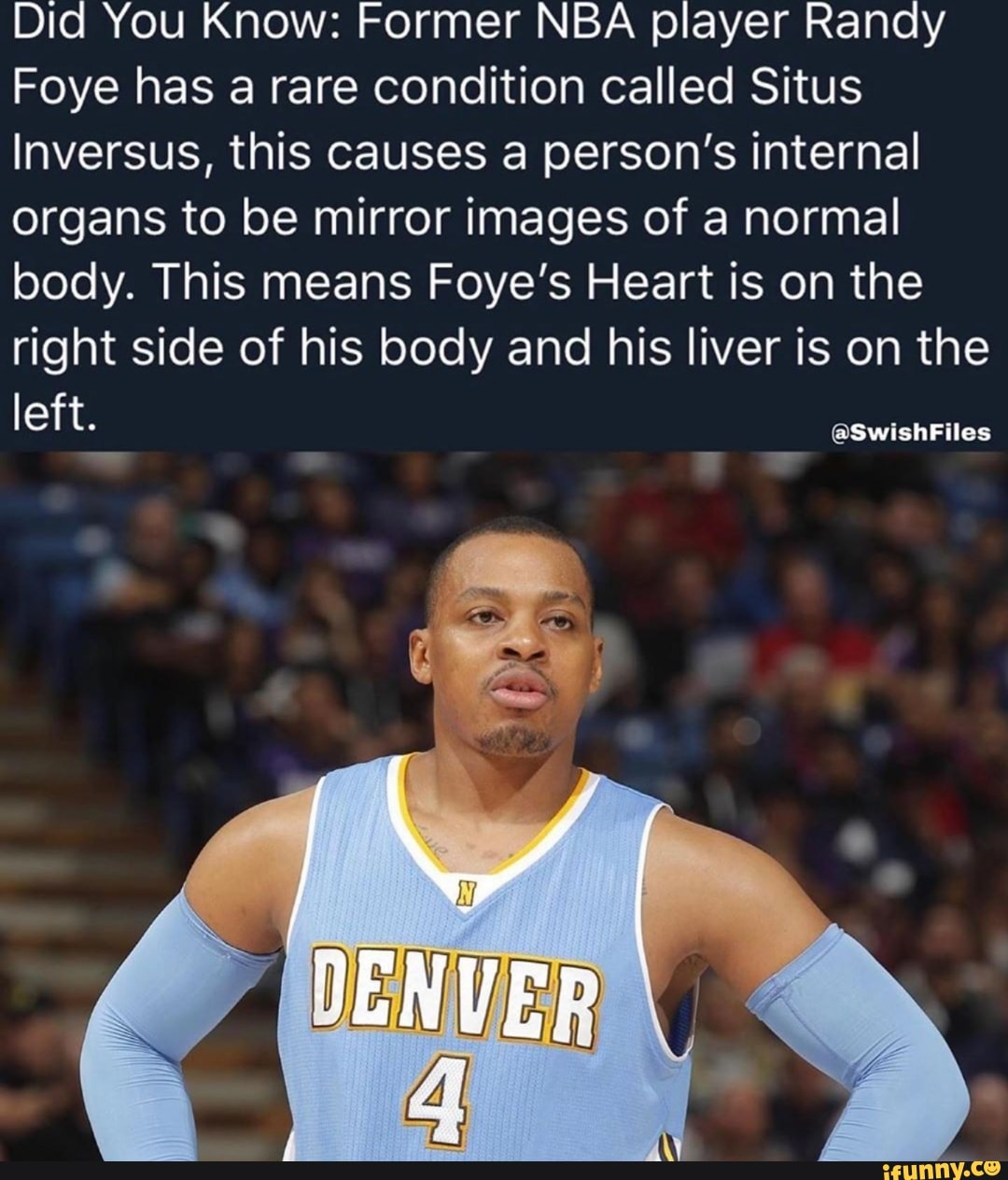 Did You Know: Former NBA player Randy Foye has a rare condition called ...