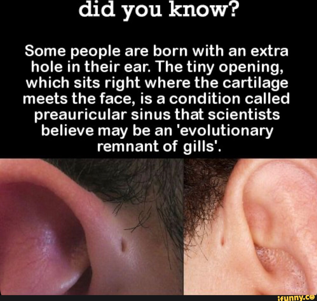 Cartilage memes. Best Collection of funny Cartilage pictures on iFunny