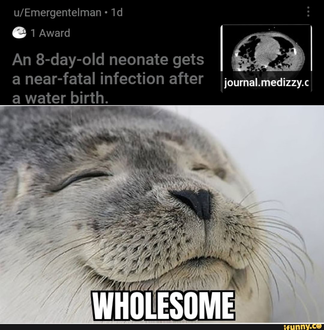 Neonate memes. Best Collection of funny Neonate pictures on iFunny