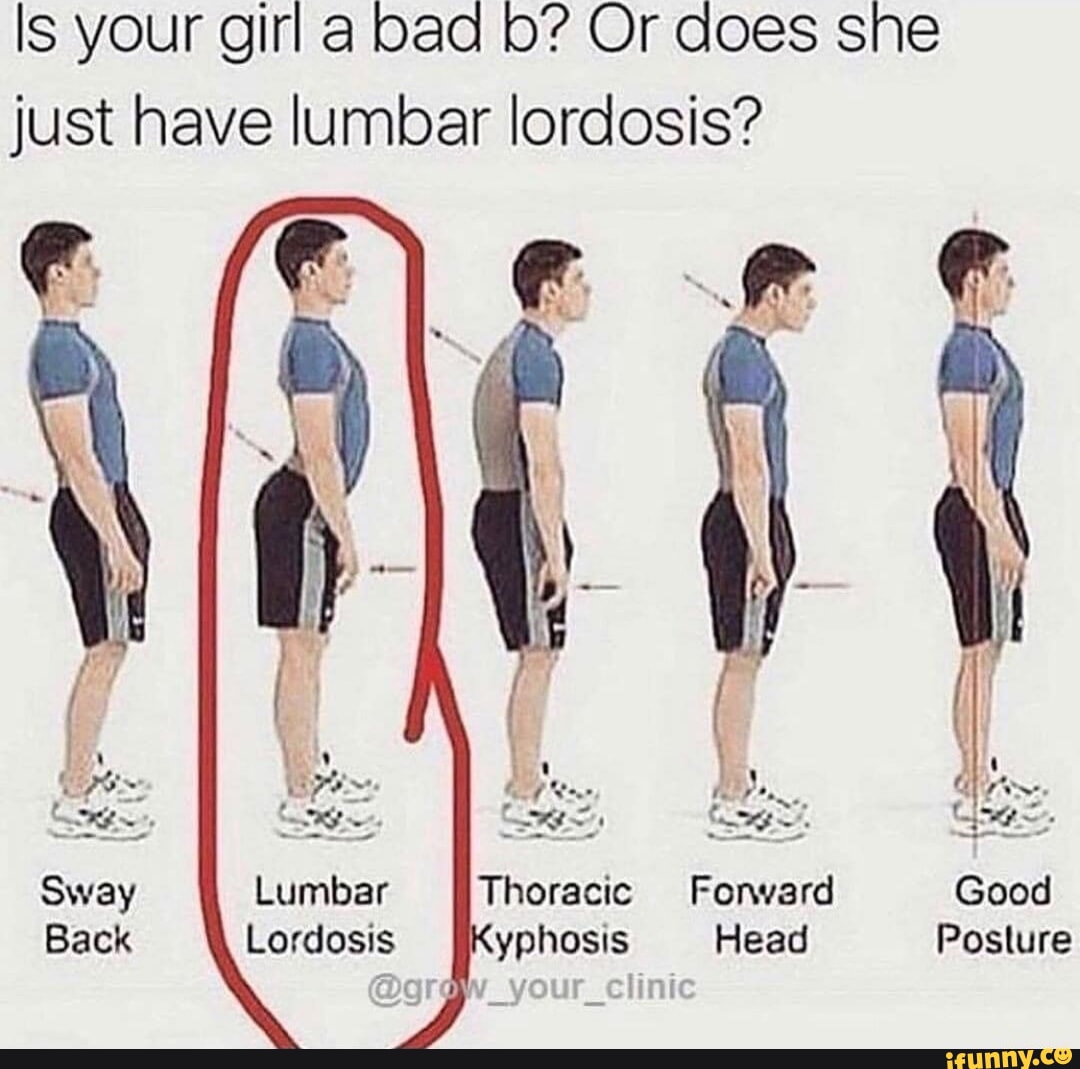 Lordosis memes. Best Collection of funny Lordosis pictures on iFunny