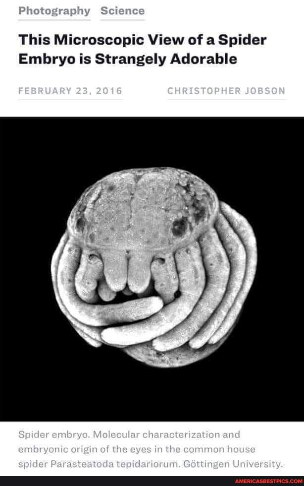 Phetography This Microscopic View of a Spider Embryo is Strangely ...