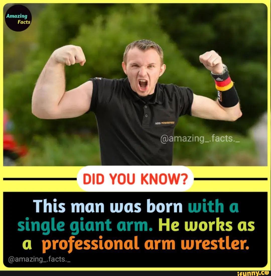 DID YOU KNOW? This man was born with single giant arm. He works as ...