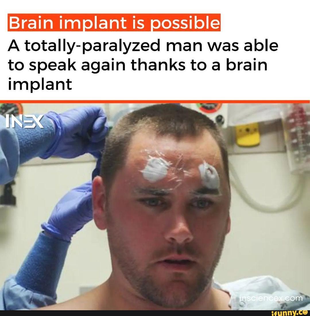 Brain implant is possible A totally-paralyzed man was able to speak again thanks to a brain ...