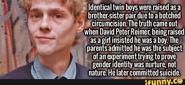 Af Identical twin boys were raised as a brother -sister pair due to a ...