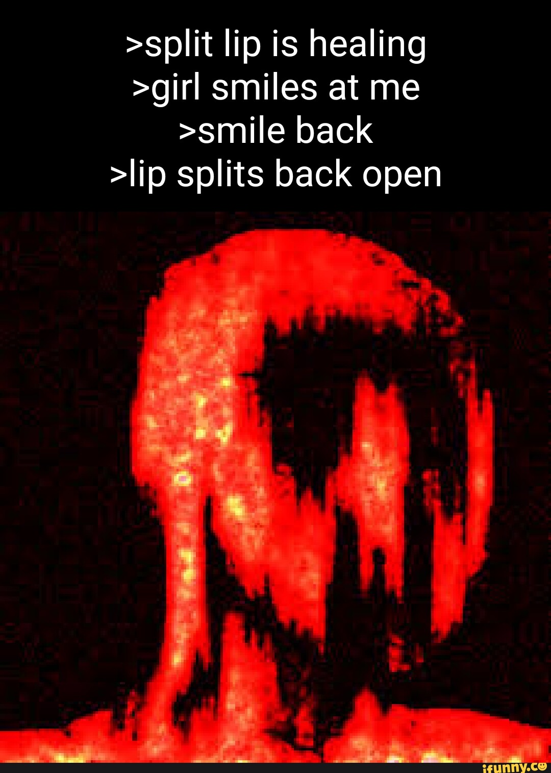 >split lip is healing >girl smiles at me >smile back >lip splits back ...