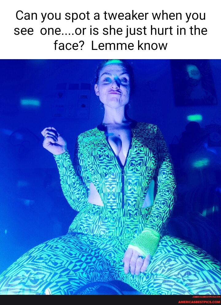 Can you spot a tweaker when you see one....or is she just hurt in the ...