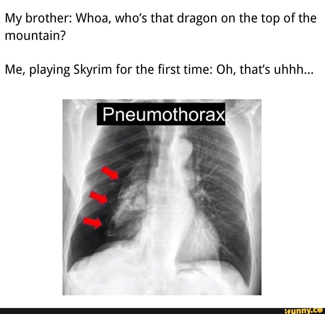 Pneumothorax memes. Best Collection of funny Pneumothorax pictures on ...