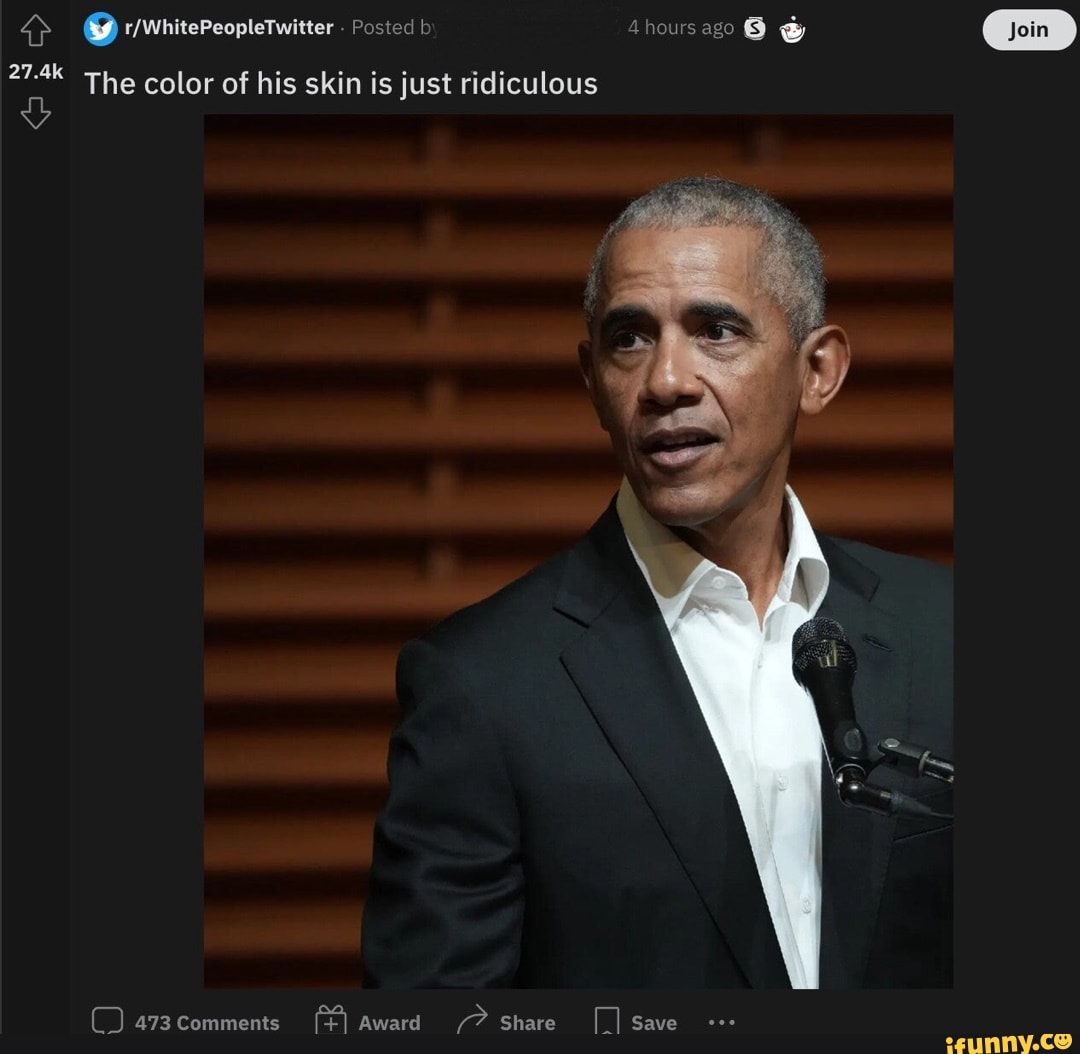 Posted b 4hoursago The color of his skin is just ridiculous 473 ...