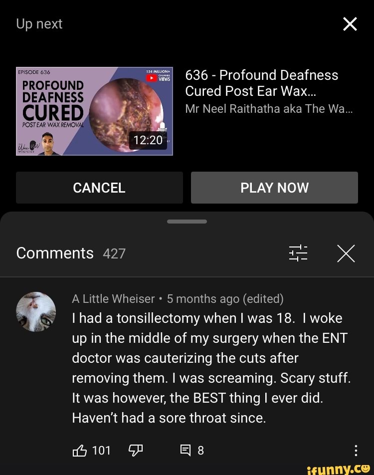 Tonsillectomy memes. Best Collection of funny Tonsillectomy pictures on ...