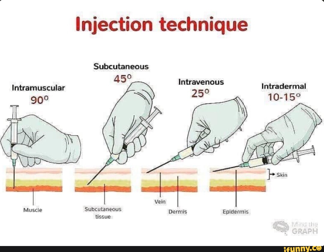 Injection technique Subcutaneous Intravenous Intradermal Subcutaneous ...