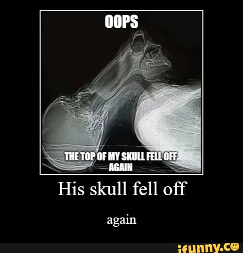 OOPS THE TOP OF SKULL FELL OFF AGAIN His skull fell off again - iFunny