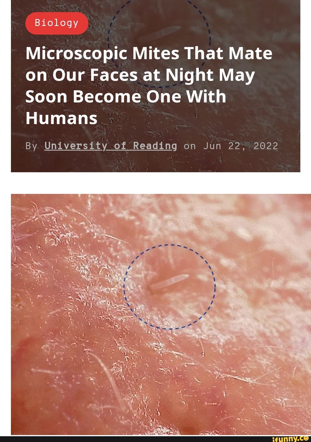 Biology Microscopic Mites That Mate on Our Faces at Night May Soon ...