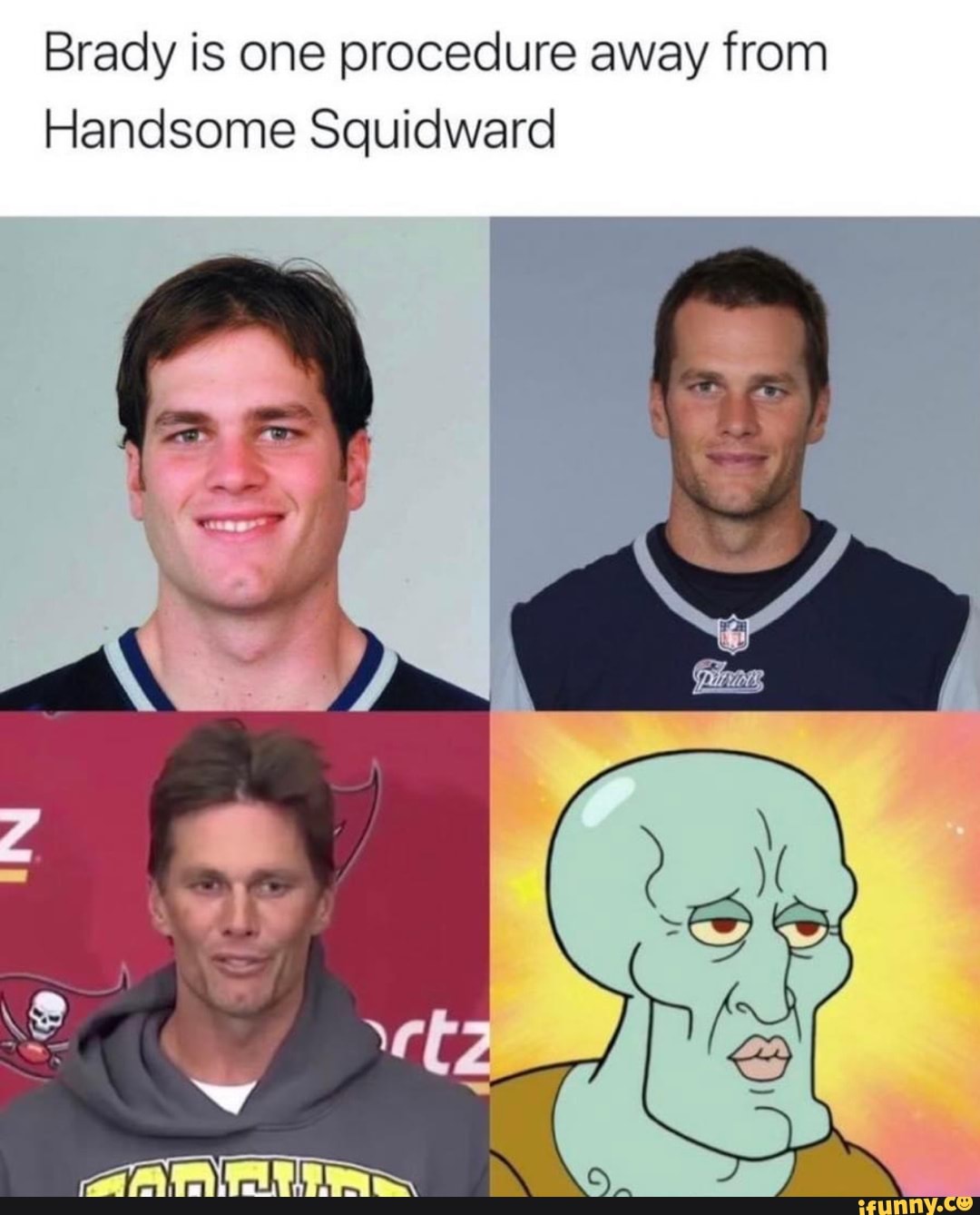 Brady is one procedure away from Handsome Squidward - iFunny