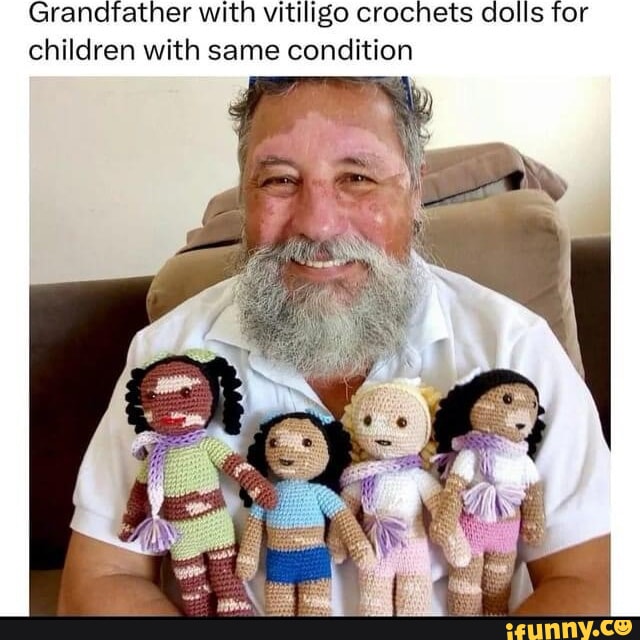 Vitiligo memes. Best Collection of funny Vitiligo pictures on iFunny