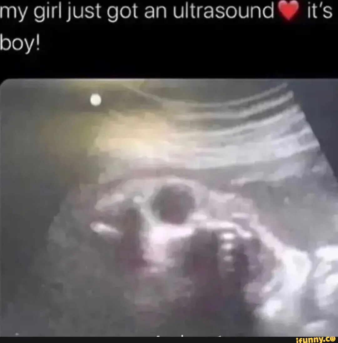 Ultrasound memes. Best Collection of funny Ultrasound pictures on iFunny