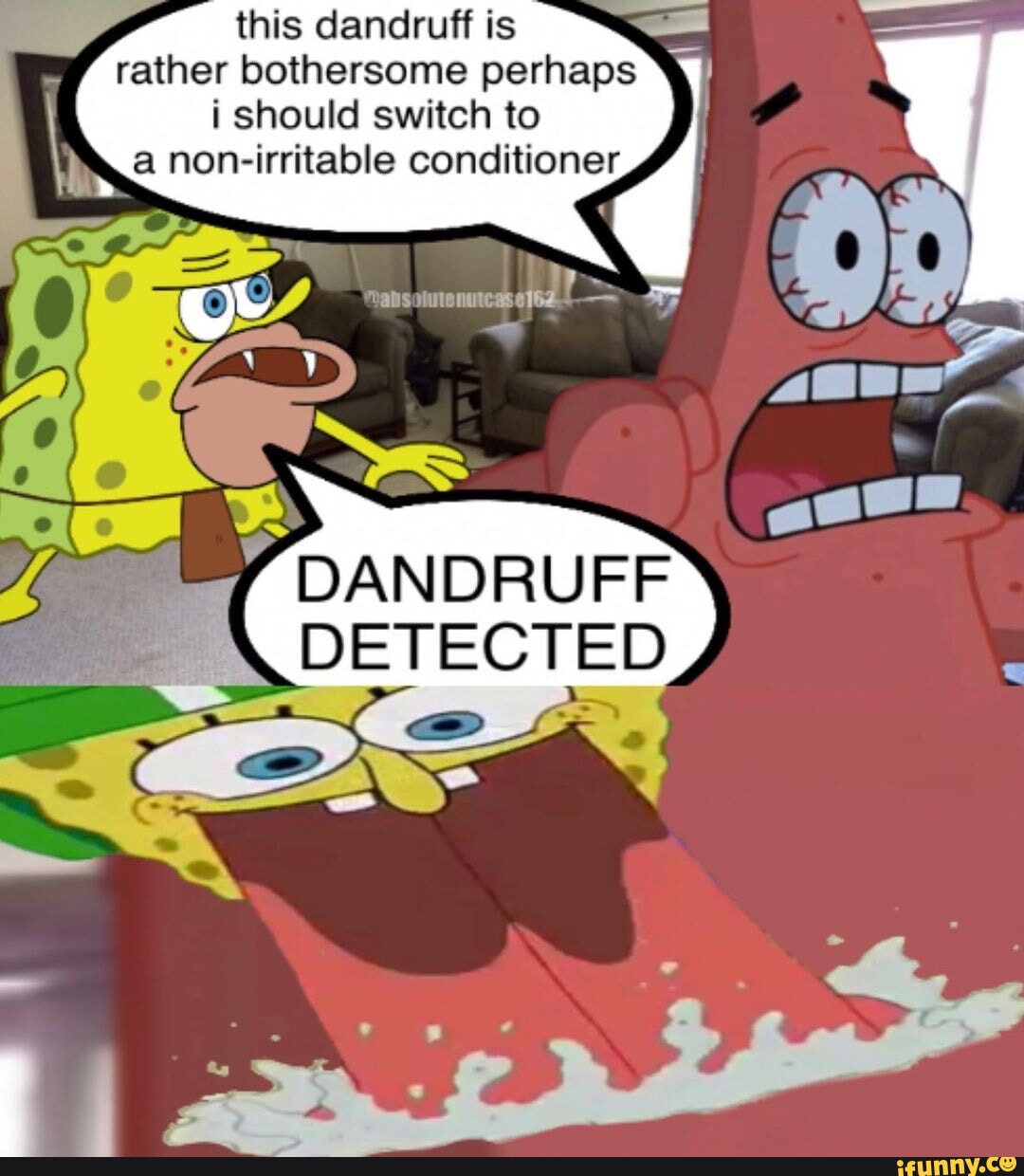 Dandruff memes. Best Collection of funny Dandruff pictures on iFunny