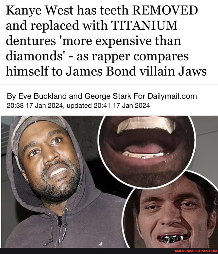 Kanye West has teeth REMOVED and replaced with TITANIUM dentures 'more ...