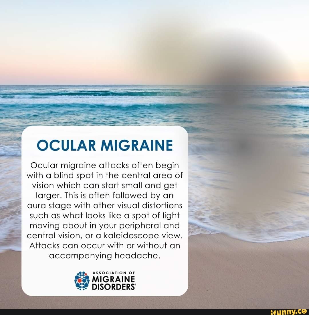 OCULAR MIGRAINE Ocular migraine attacks often begin with a blind spot ...
