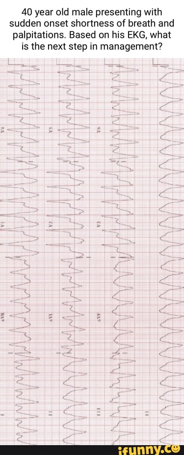 EKG memes. Best Collection of funny EKG pictures on iFunny
