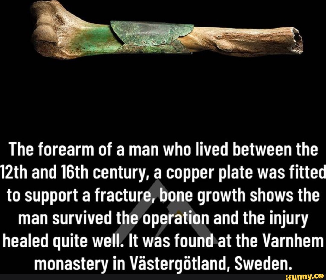 Fracture memes. Best Collection of funny Fracture pictures on iFunny