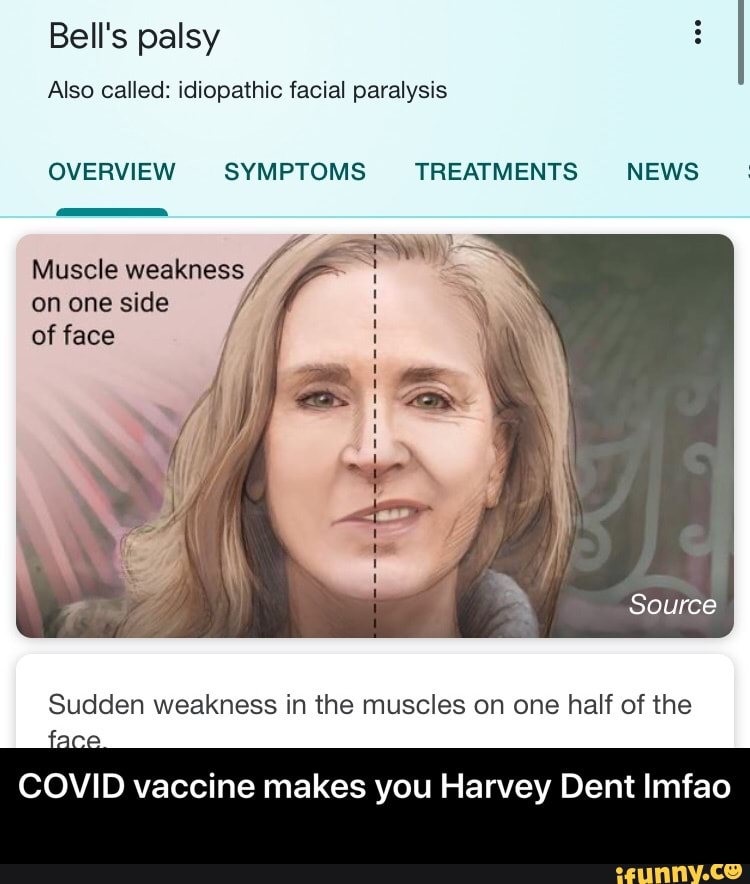 Bell's palsy Also called: idiopathic facial paralysis OVERVIEW SYMPTOMS ...