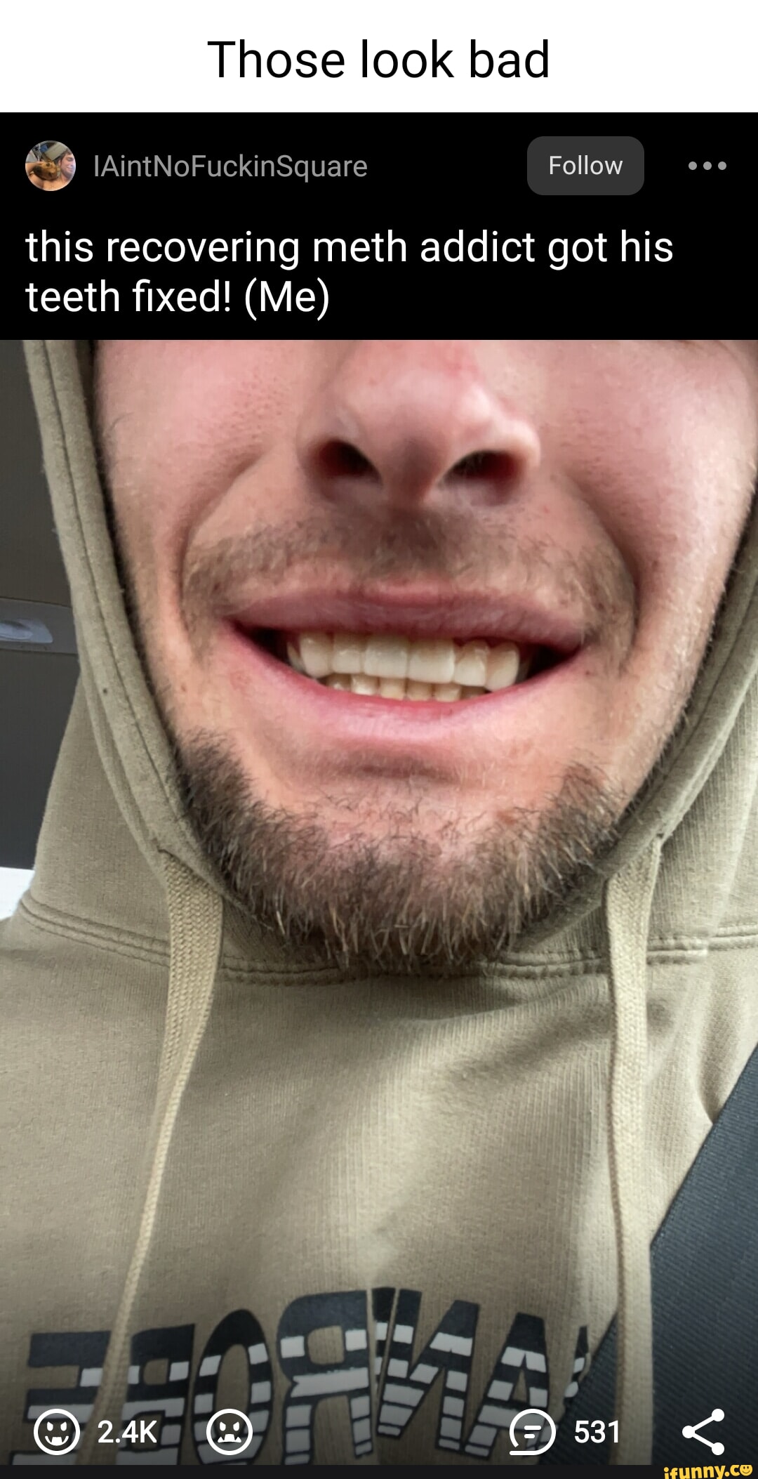 Those look bad IAintNoFuckinSquare this recovering meth addict got his ...